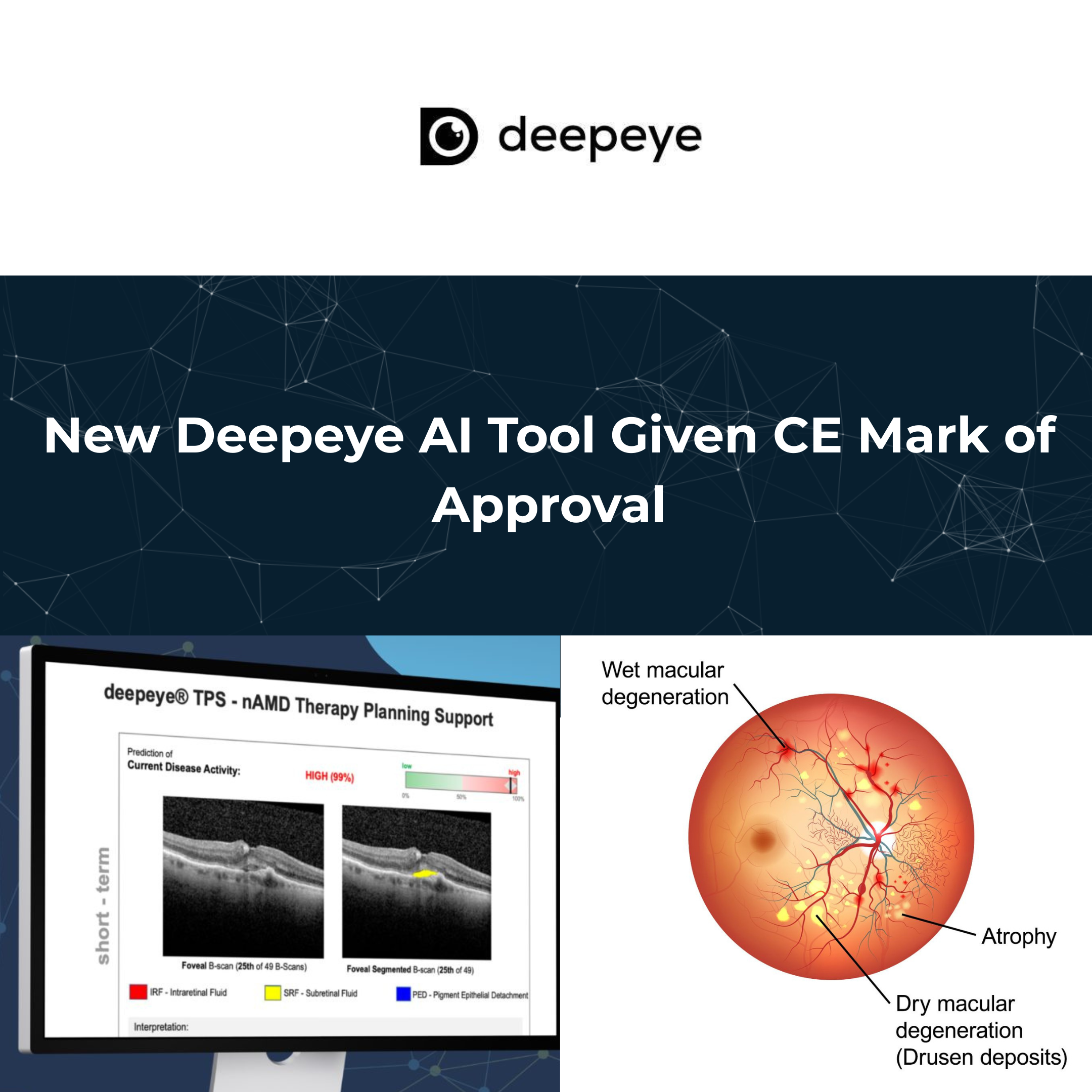 Deepeye Medical Receive CE Mark for New Platform